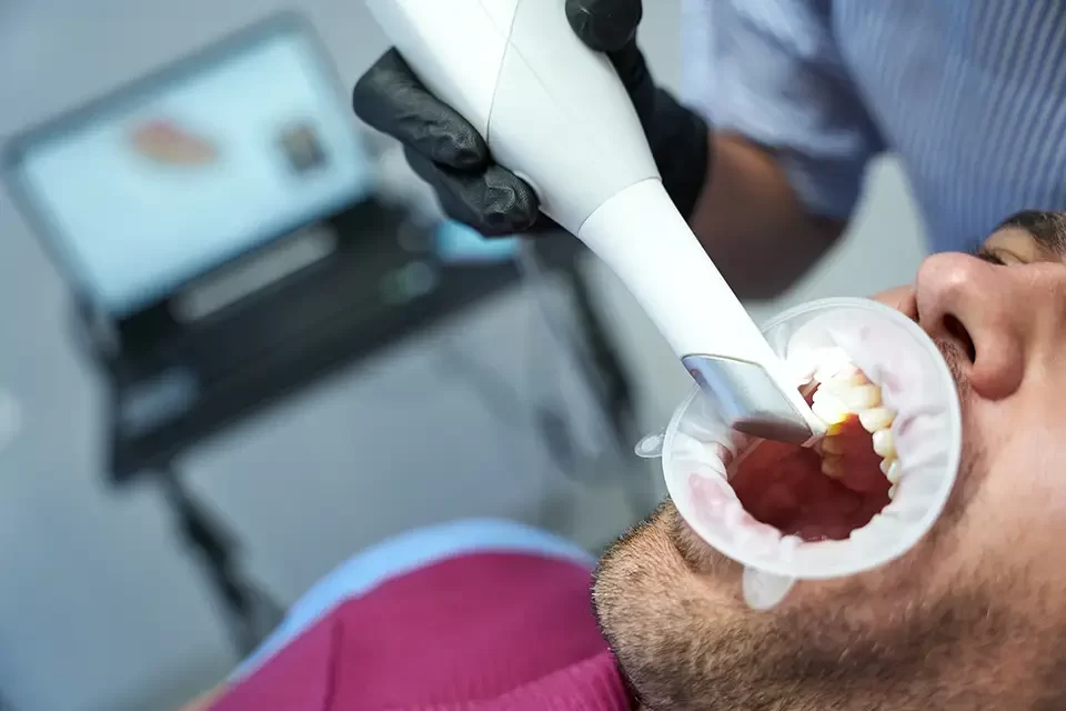 LANAP Laser Gum Surgery | Effective Gum Disease Treatment